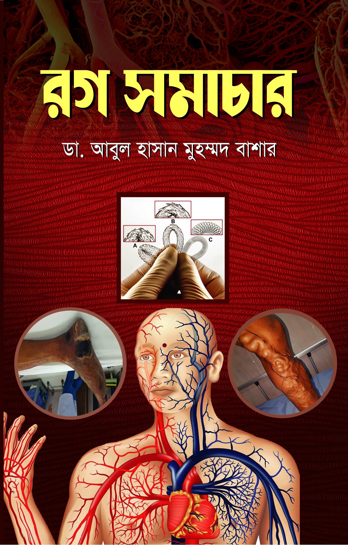 রগ সমাচার - ডা. আবুল হাসান মুহম্মদ বাশার | Rog Somachar | Wafilife